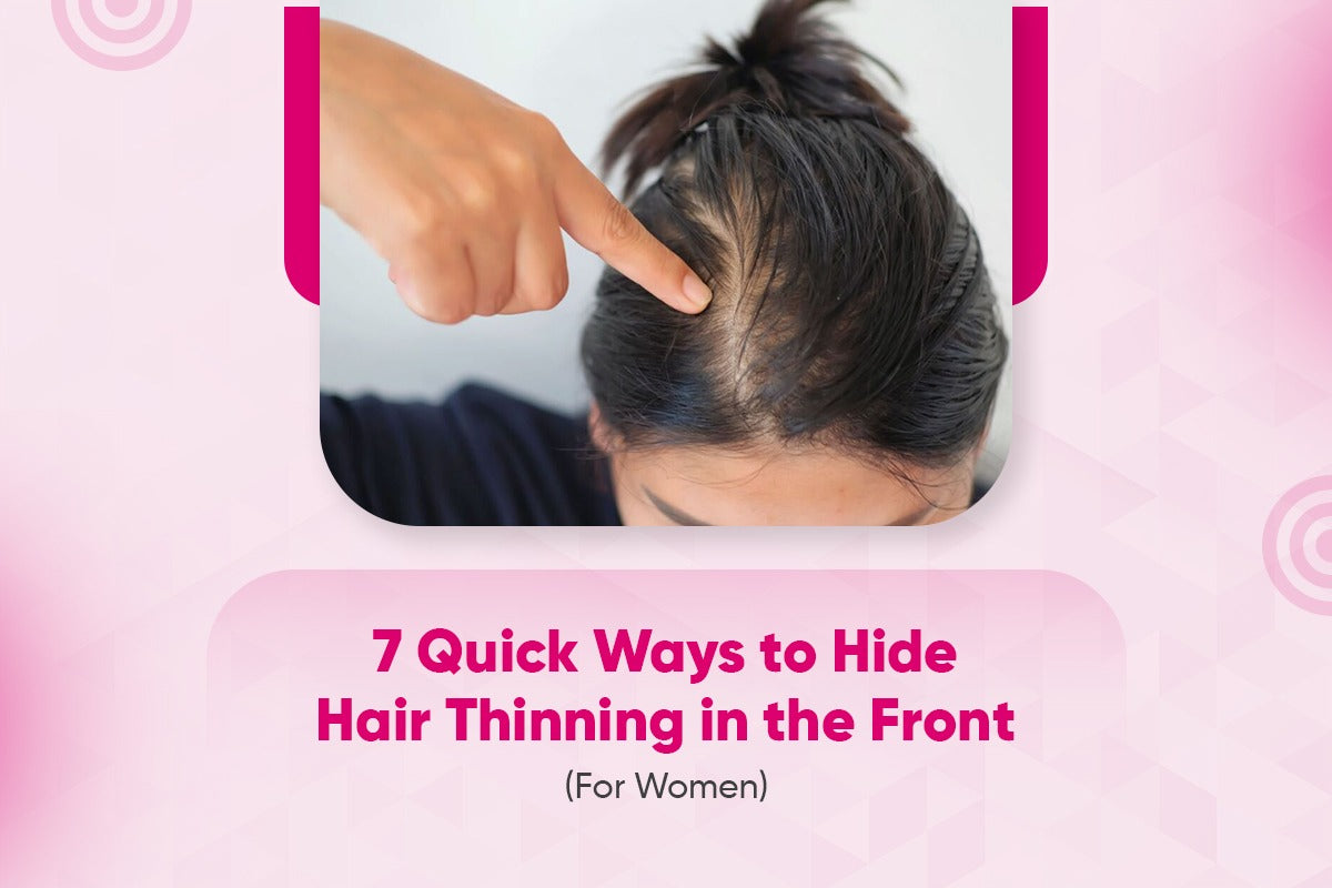 7 Quick Ways to Hide Hair Thinning in the Front (for women) – GorgeousHair