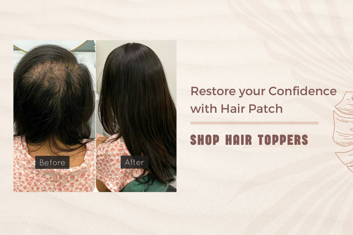 Restore Your Confidence With Hair Patch: A Non-Surgical Solution for H ...
