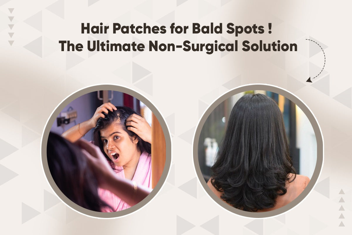 Hair Patches for Bald Spots: The Ultimate Non-Surgical Solution ...