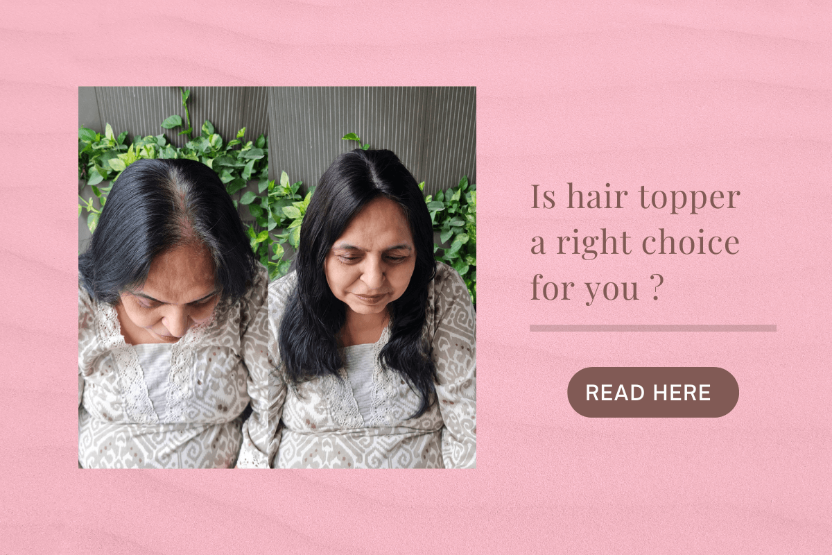 Best Quality Hair Patch | Hair Patch Online - The Gorgeous Hair ...