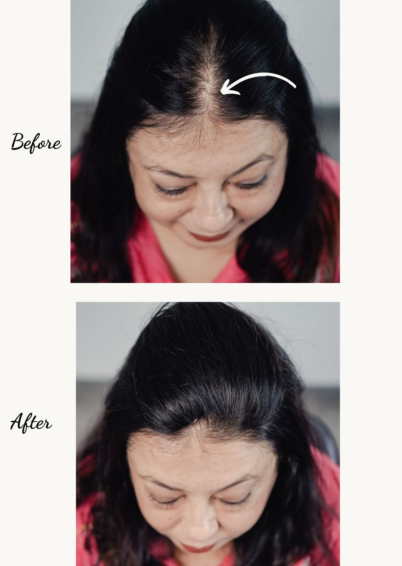 Cover-up Patches - Cover Up Patch for Hair Online – GorgeousHair